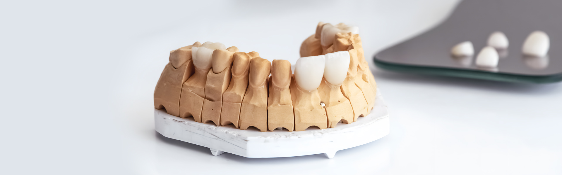 Porcelain Veneers in Temecula, CA | Perfect Your Smile